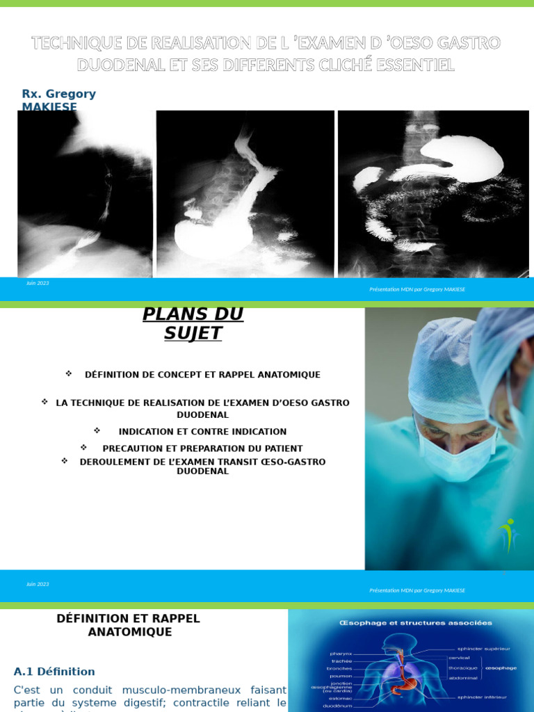 Présentation DODO | PDF | Œsophage | Appareil digestif