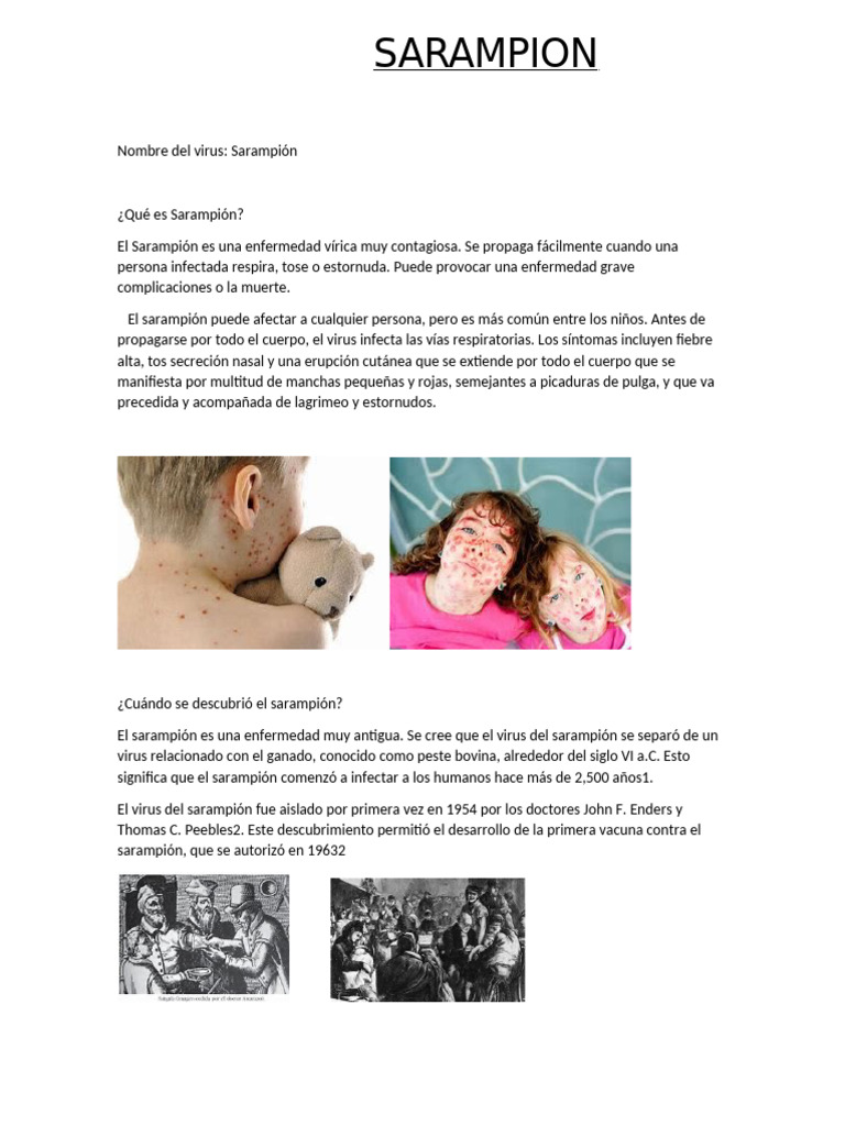 Sarampión | PDF
