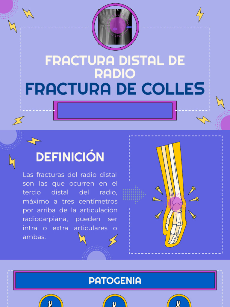 Fractura de Colles | PDF