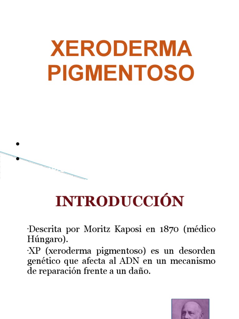 Xeroderma Pigmentoso | PDF | Cáncer | Adn