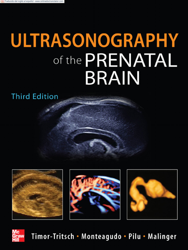Ultrason of The Prenatal Brain (001-010) | PDF
