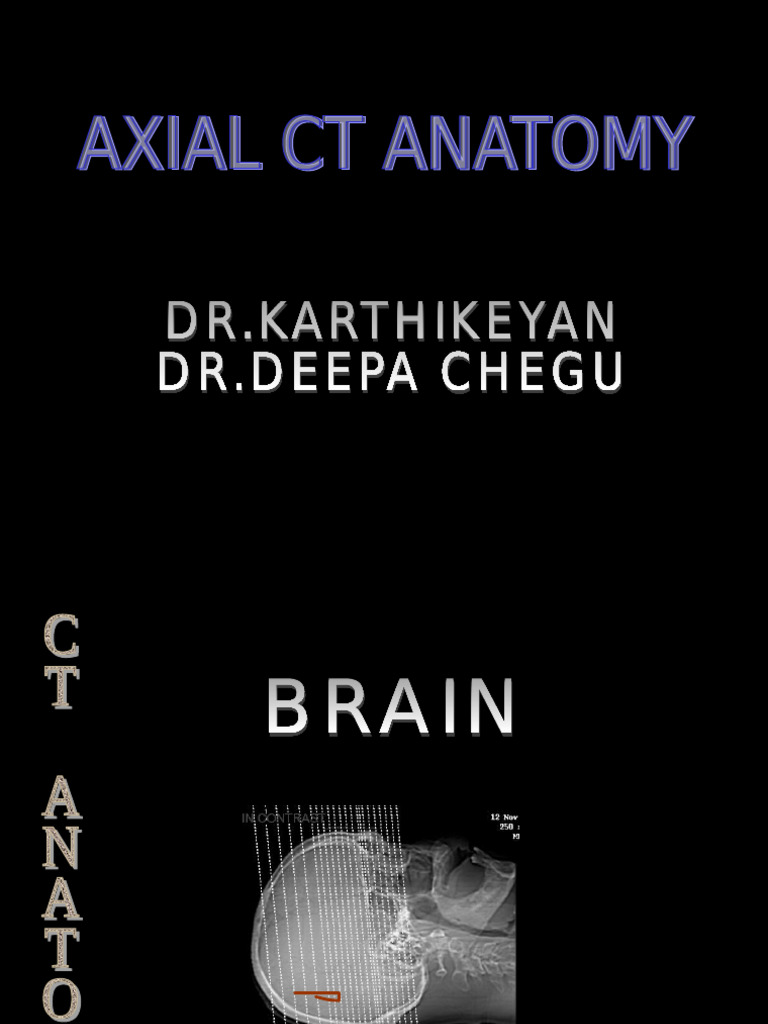 ct anatomy | PDF