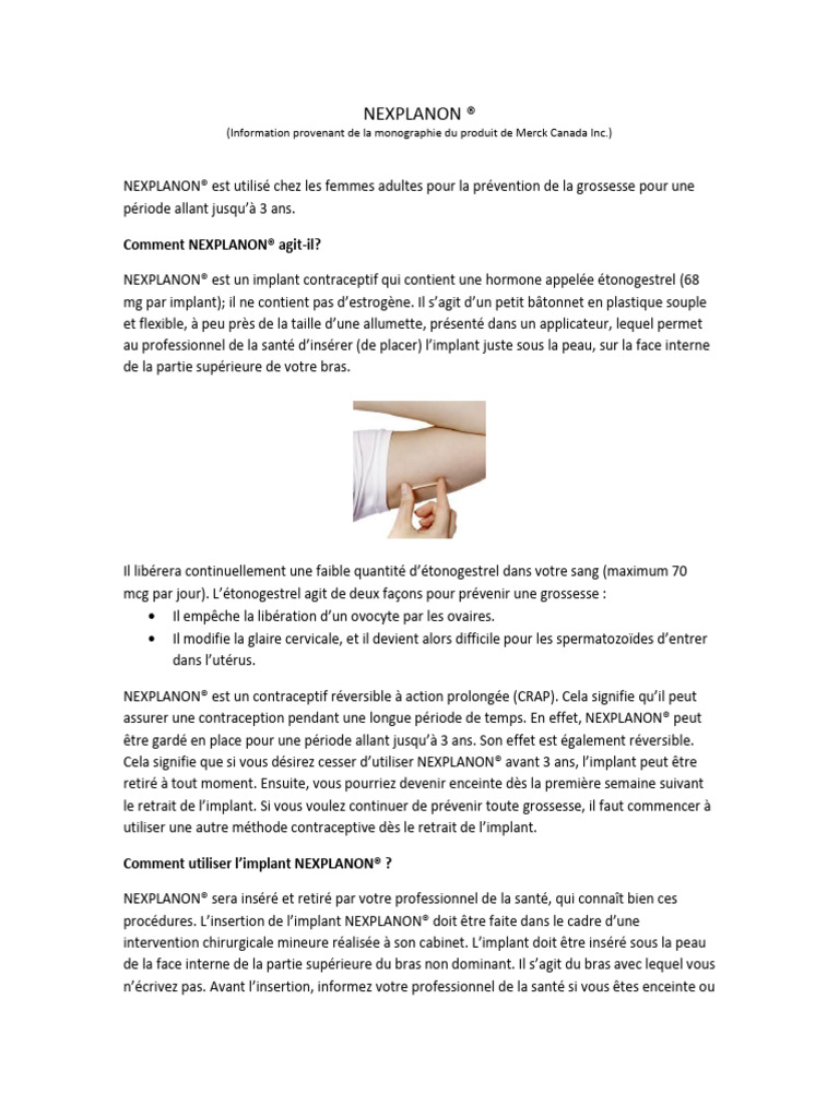 Nexplanon Info FR | PDF