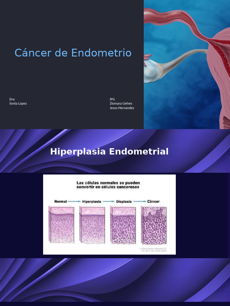 Cancer de Endometrio | PDF