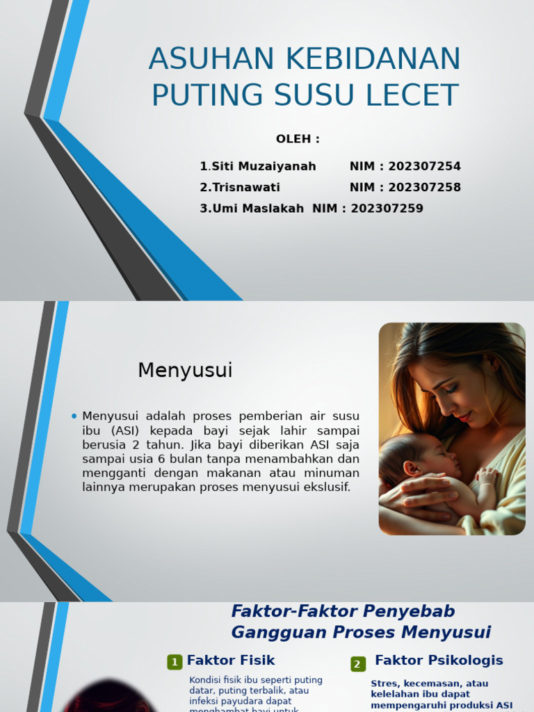 Presentasi Asuhan Kebidanan Nifas Dengan Puting Susu Lecet Di | PDF