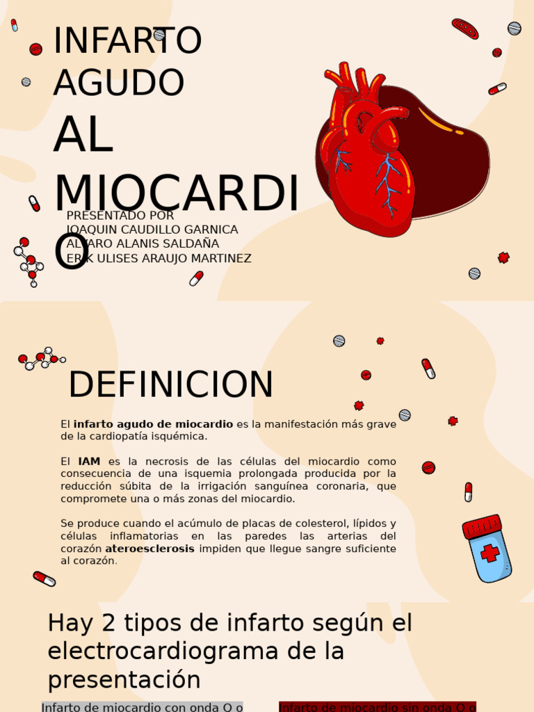 Infarto Agudo de Miocardio: Causas y Tratamiento | PDF | Infarto de ...