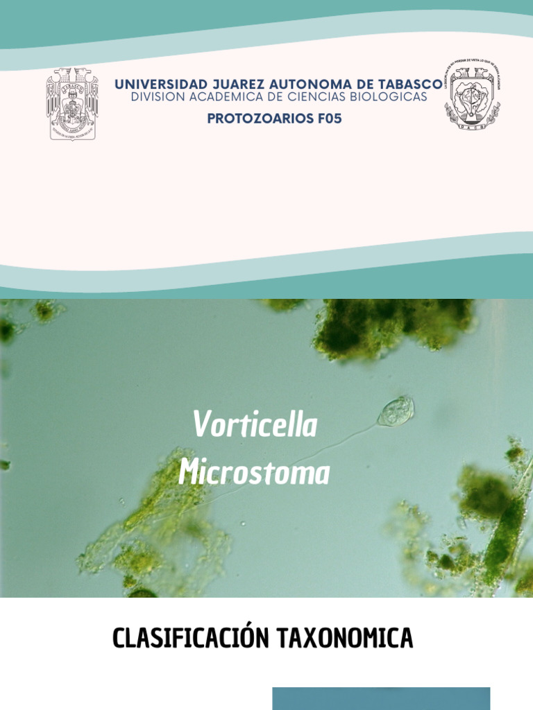Vorticella microstoma: Hábitat y Morfología | PDF | Organismos | Naturaleza