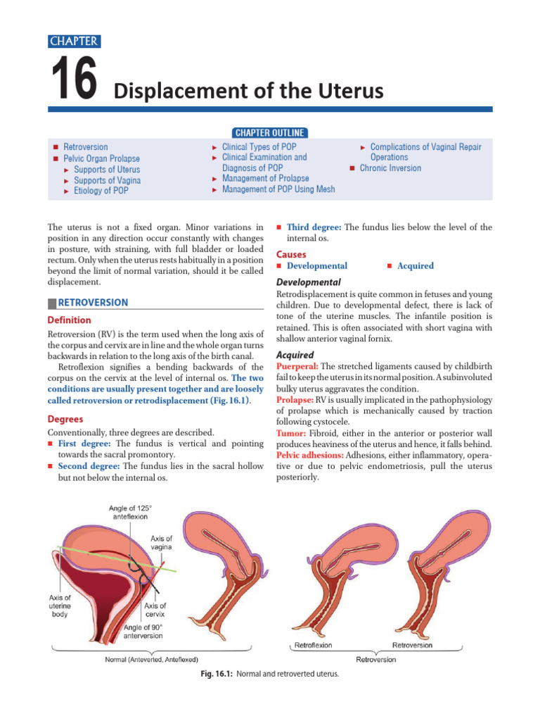 16 Displacement of The Uterus | PDF