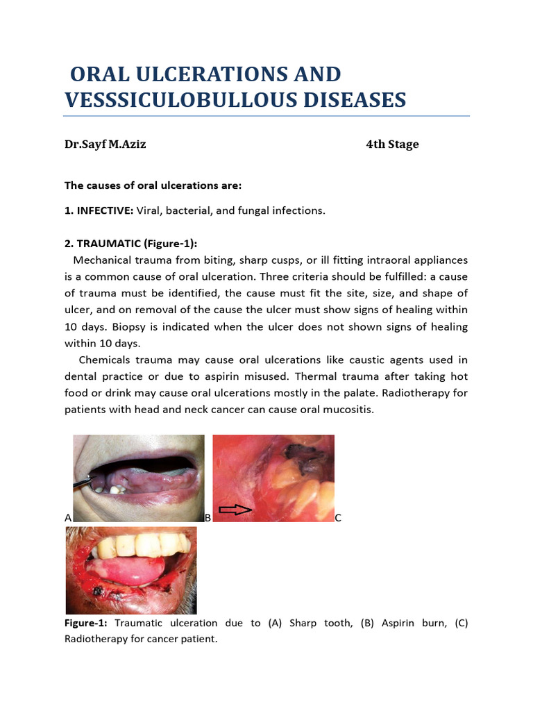 Oral Ulcerations and Vesiculobullous Diseases | PDF
