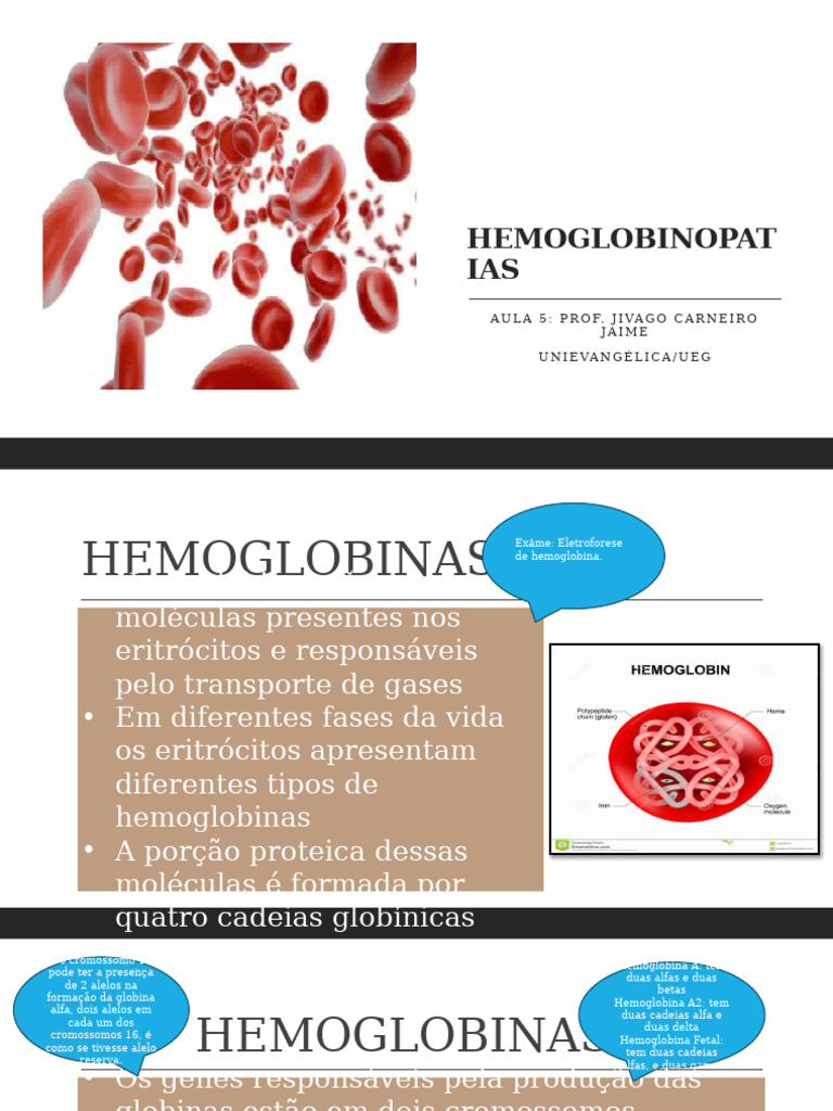 Aula 5 - Hemoglobinopatias-3 | PDF