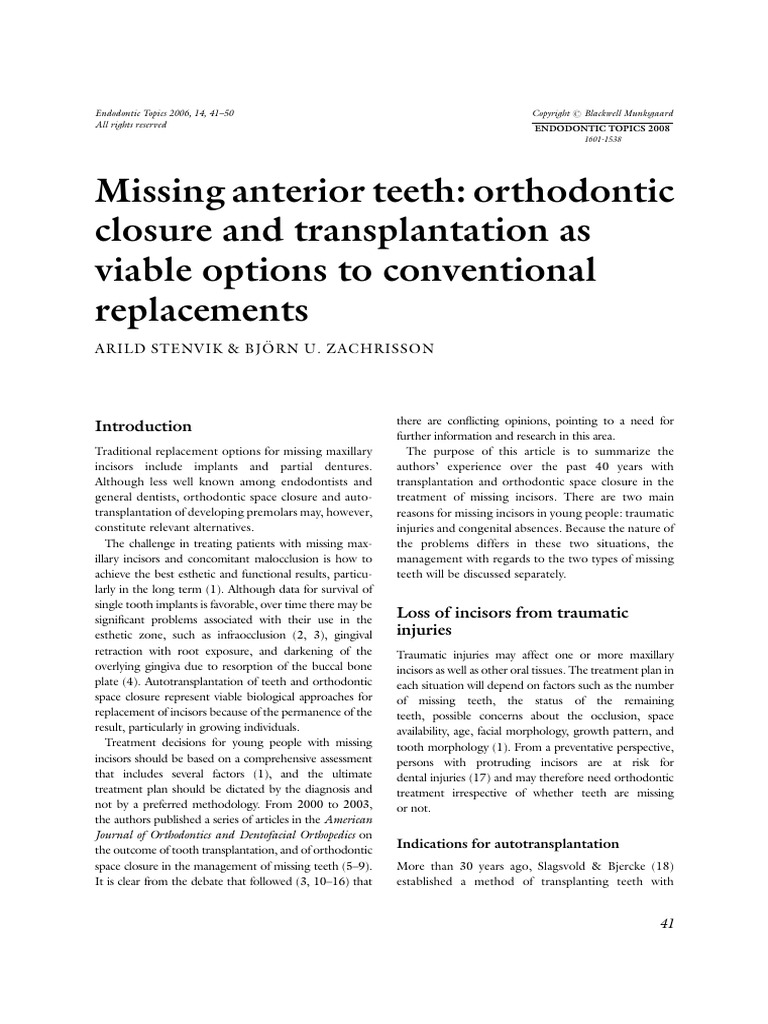 Missing Anterior Teeth - Orthodontic Closure and Transplantation As ...