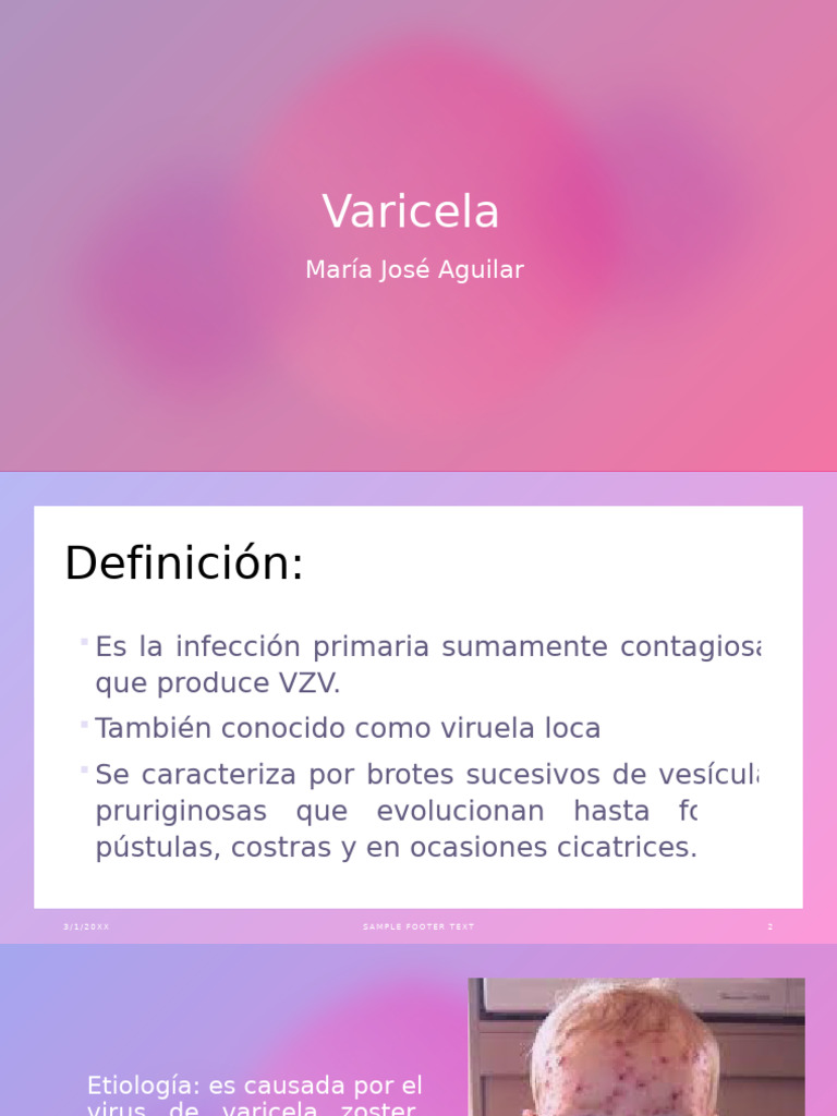 Varicela | PDF