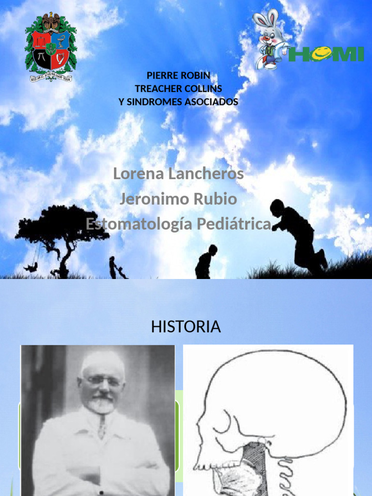 Pierre Robin Treacher Collins | PDF