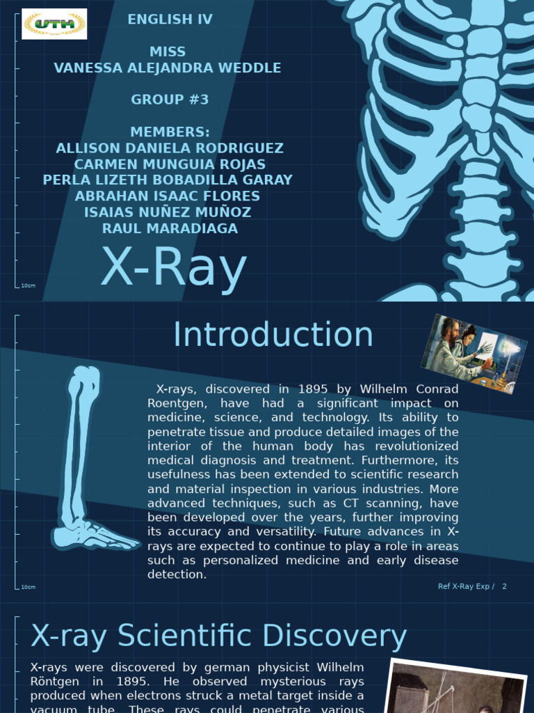 X Ray Presentation 1 | PDF