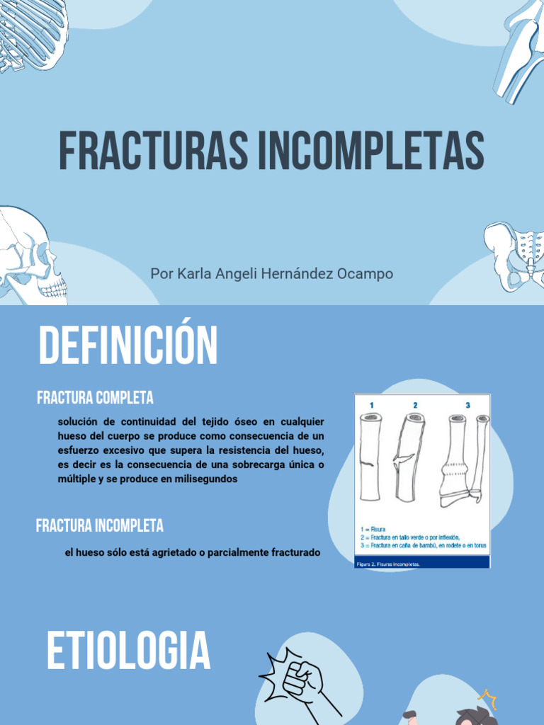 FRACTURAS INCOMPLETAS | PDF