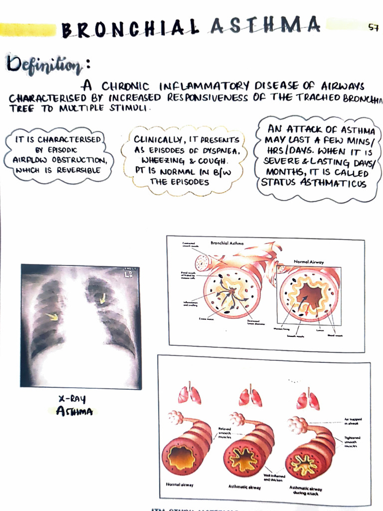 Asthma, COPD | PDF | Chronic Obstructive Pulmonary Disease | Pneumonia