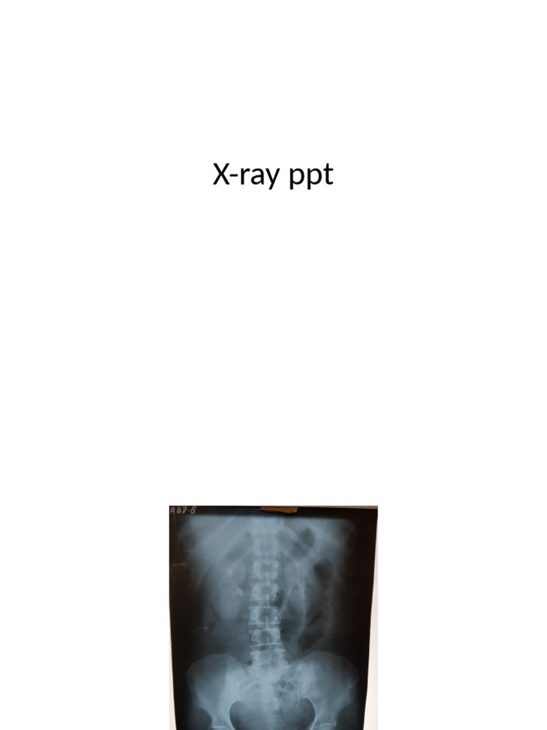 X Ray PPT - Viva | PDF