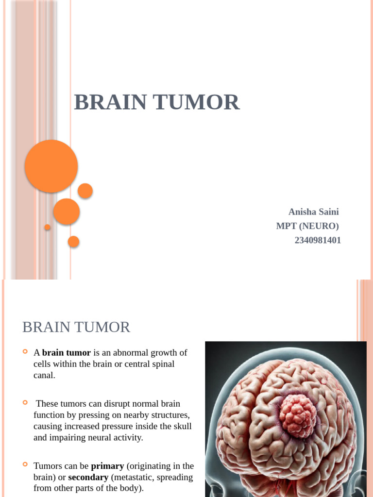 Brain Tumor | PDF