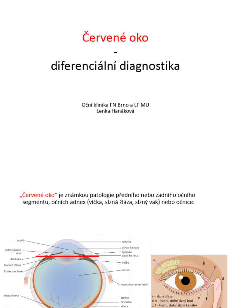 Cervene Oko - Diff. Dg. | PDF