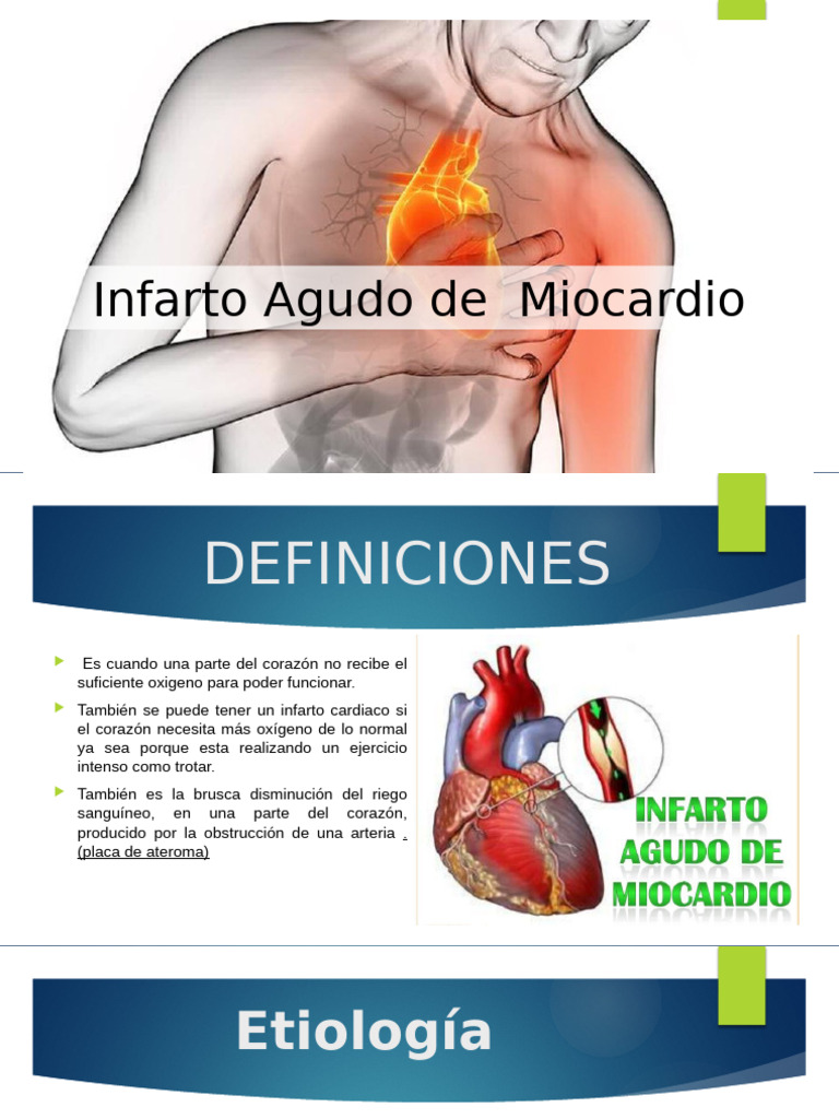 Síntomas y Tratamiento del Infarto Agudo | PDF | Infarto de miocardio ...