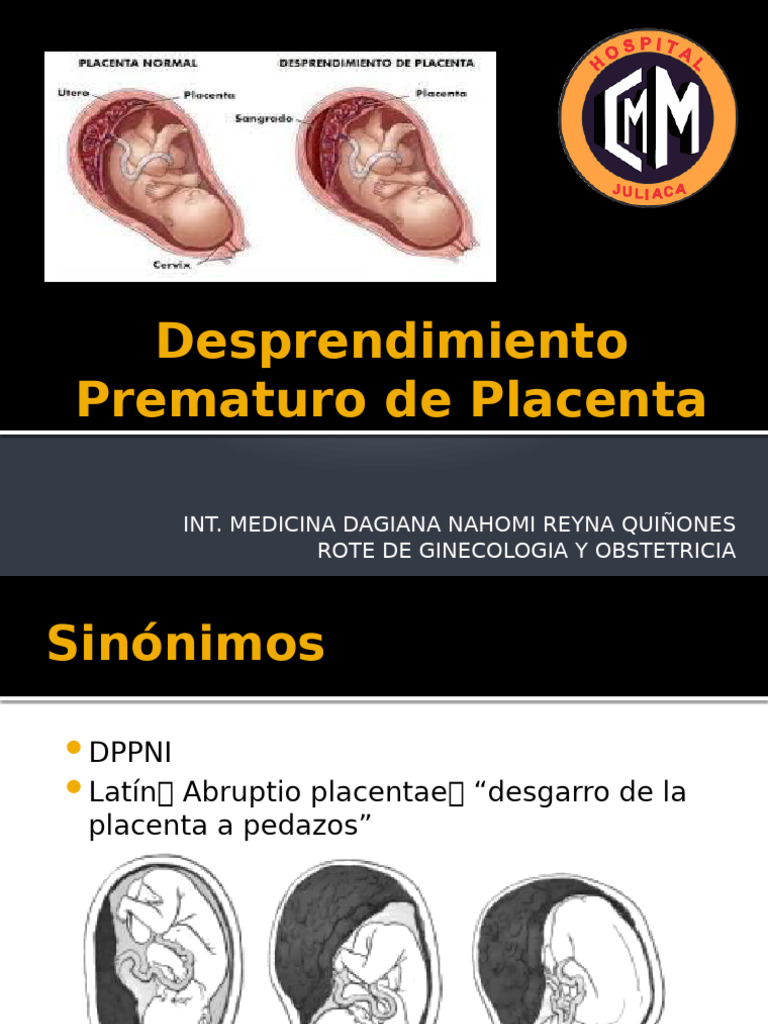 Dppni-Dagiana Nahomi Reyna Quiñones 1 | PDF | Feto | Parto prematuro