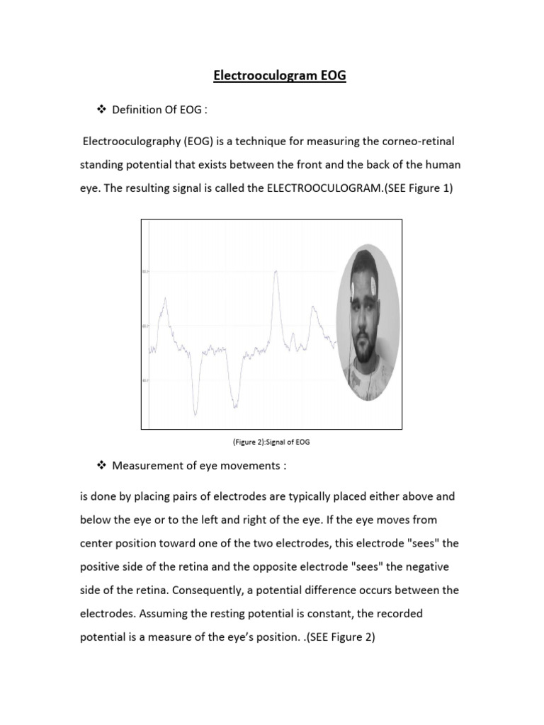 Electrooculogram EOG: Potential Is A Measure of The Eye's Position | PDF