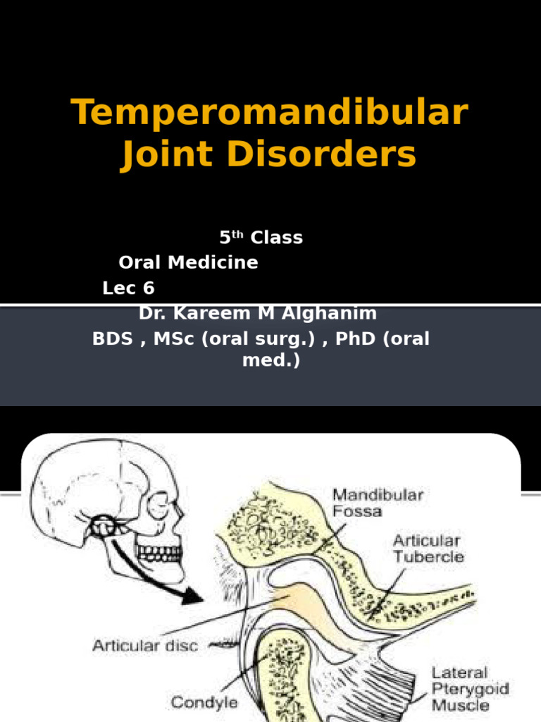 Lec.4 TMJ Part.2 | PDF | Arthritis | Medicine