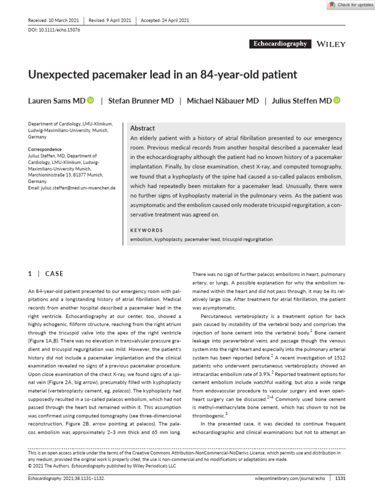 Unexpected Pacemaker Lead in An 84-Year-Old Patient | PDF | Heart ...