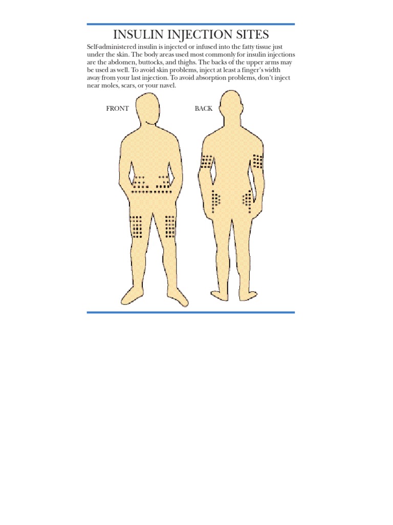 Insulin Injection Sites and Insulin Info | PDF | Disorders Of Endocrine ...