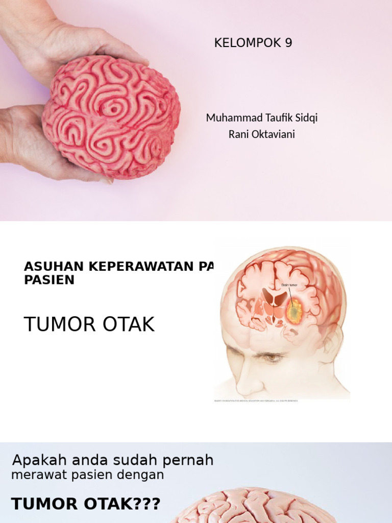 Tumor Otak | PDF