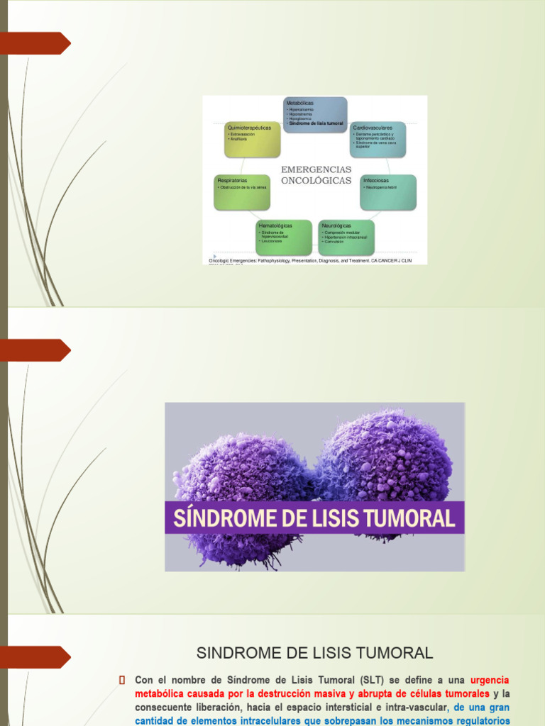 SINDROME DE LISIS TUMORAL | PDF