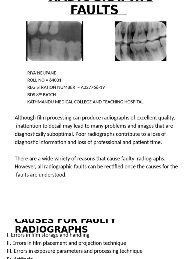 Radiographic Faults | PDF