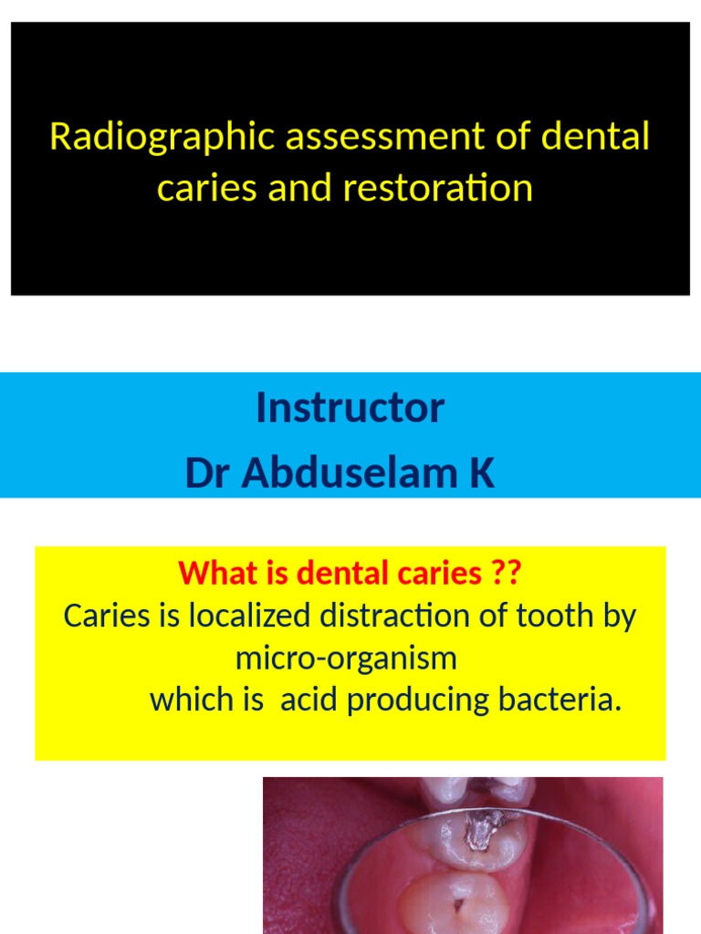 Radiographic Assessment of Dental Caries and Restoration Lecture | PDF