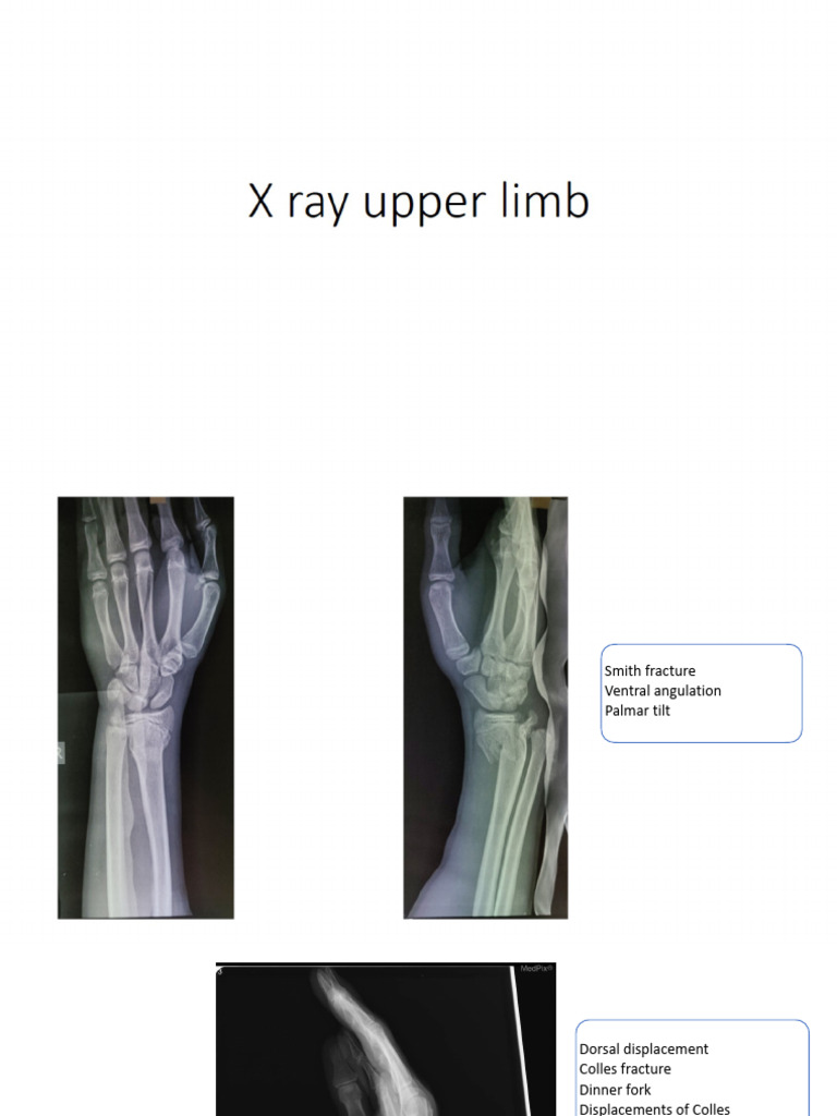 Ortho X-Ray | PDF