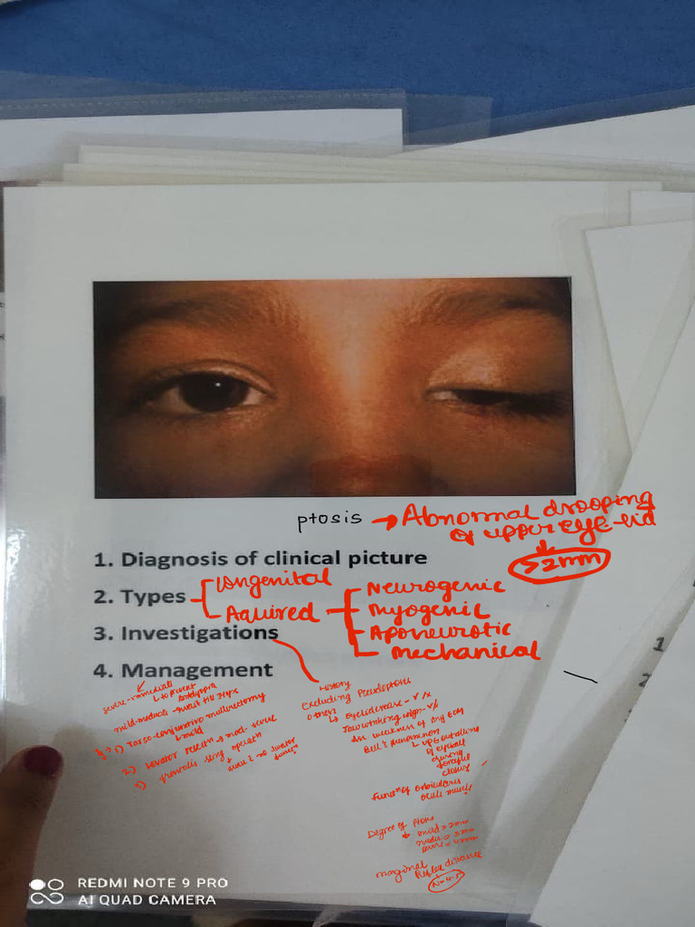Osce Ophthal | PDF