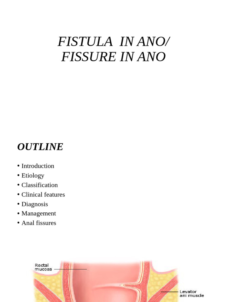 Fistula in Ano | PDF