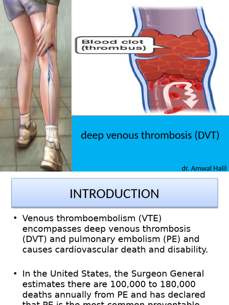 AW Tugas PPT DVT | PDF