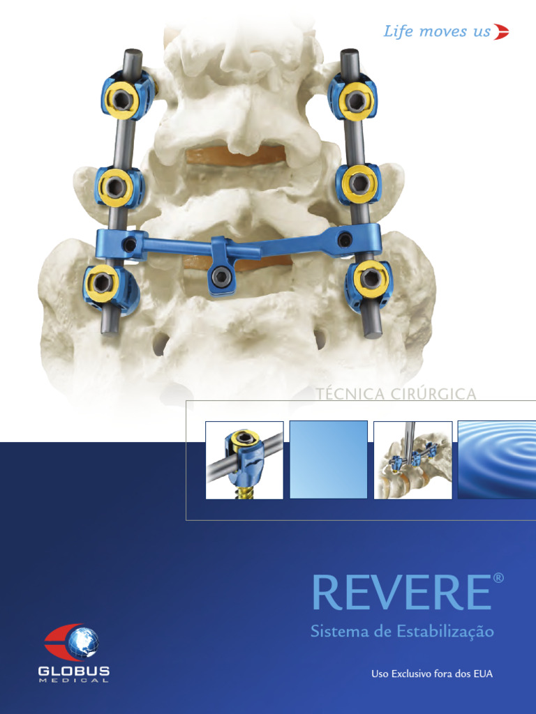Gmtgd17pr Revere55 Techniqueguide Reva | PDF