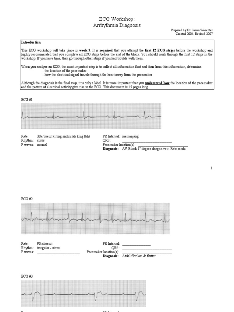 ECG Workshop 2006 | PDF | Electrocardiography | Artificial Cardiac ...