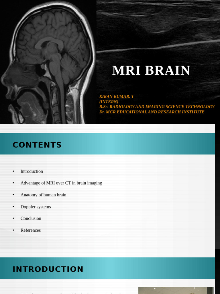 Mri Brain | PDF