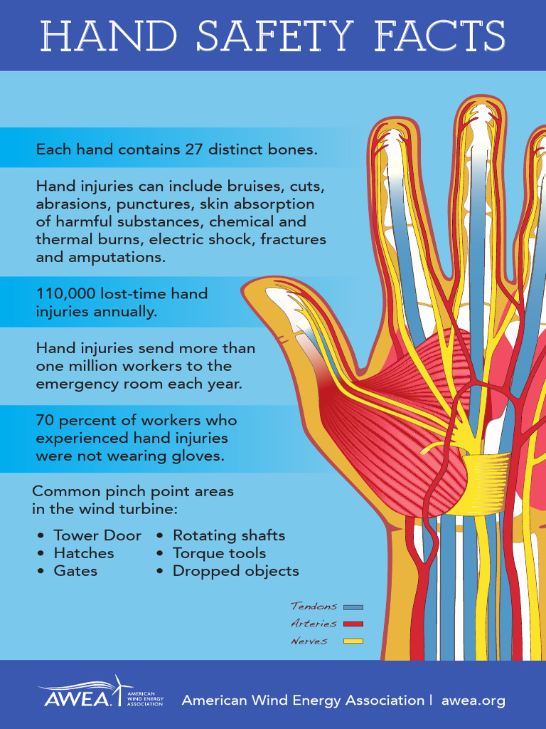 AWEA Poster Hand-Safety-Facts 2 | PDF