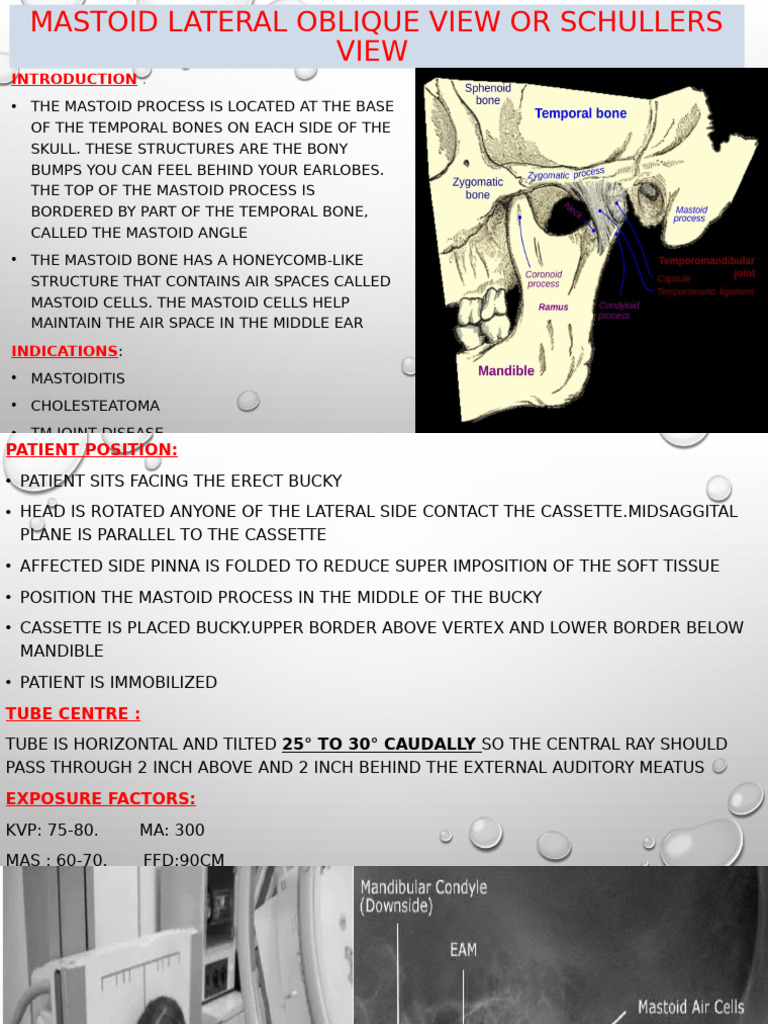 Mastoid Views . | PDF