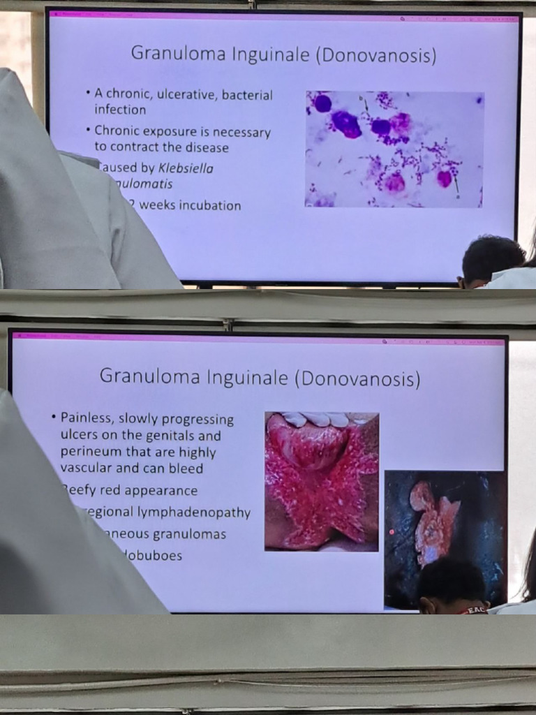 Genital Tract Infections Gynae | PDF