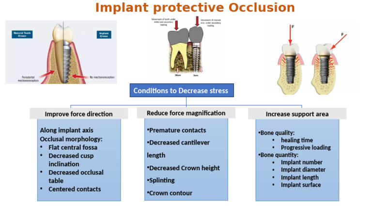 Implant protective Occlusion PEDAGOGY | PDF