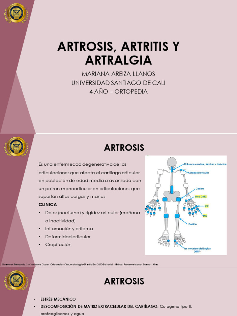 Artrosis, Artritis y Artralgia: Guía Clínica | PDF | Artritis ...
