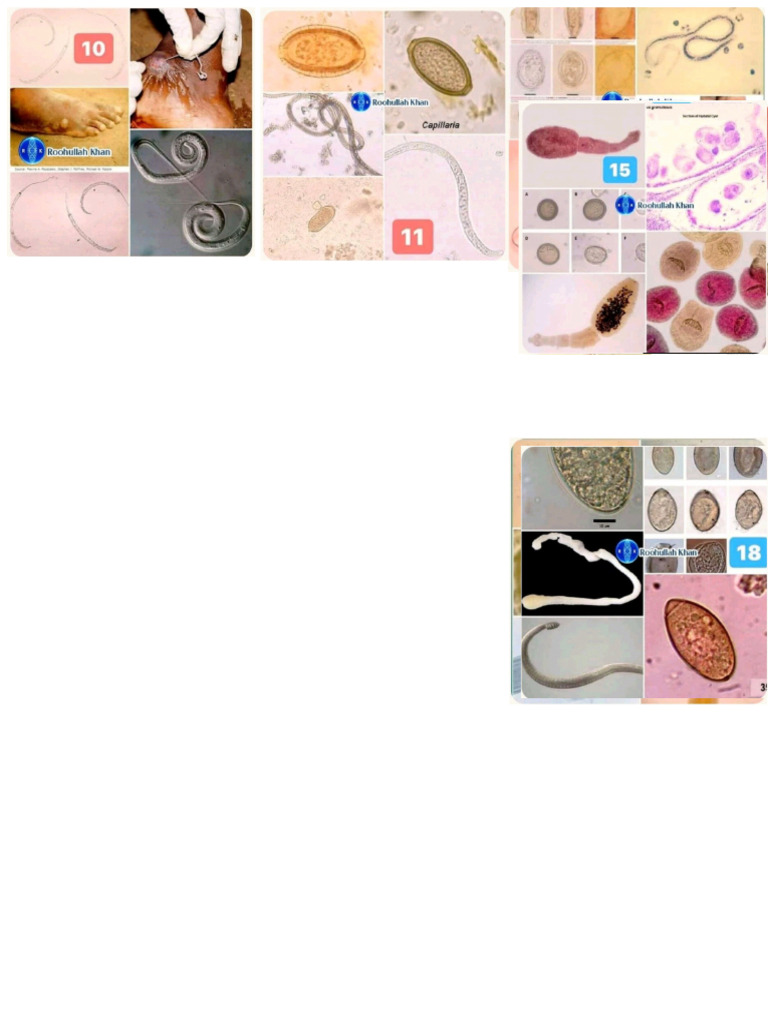Worms | PDF