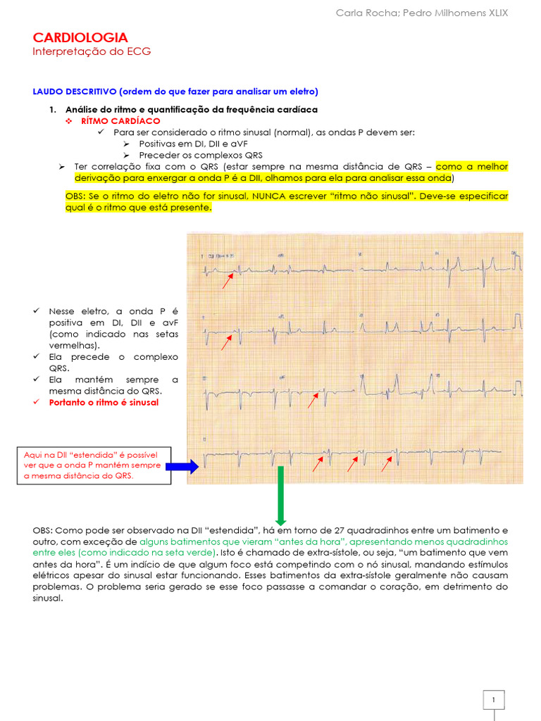 Resumo Pedro Miranda - Interpretação Do ECG | PDF