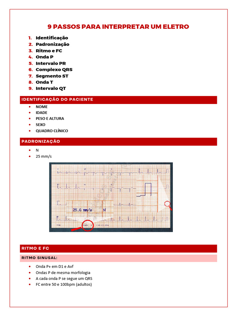 9 Passos para Interpretar Um Eletro | PDF