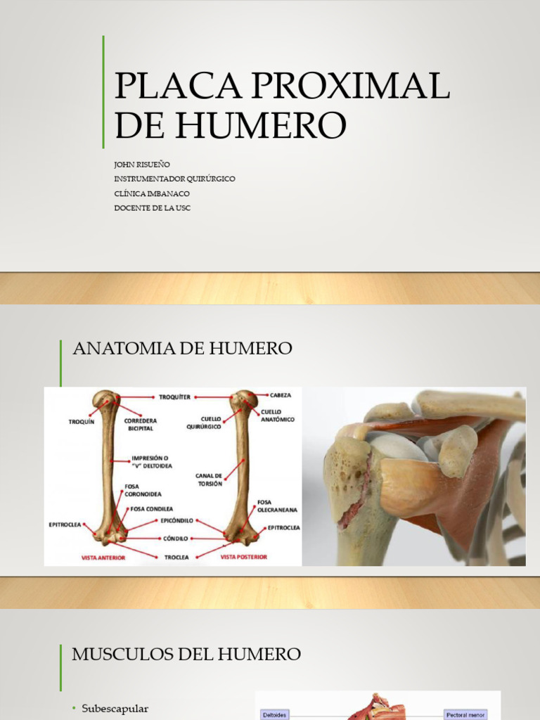 PLACA PHILOS PARA HUMERO PROXIMAL | PDF