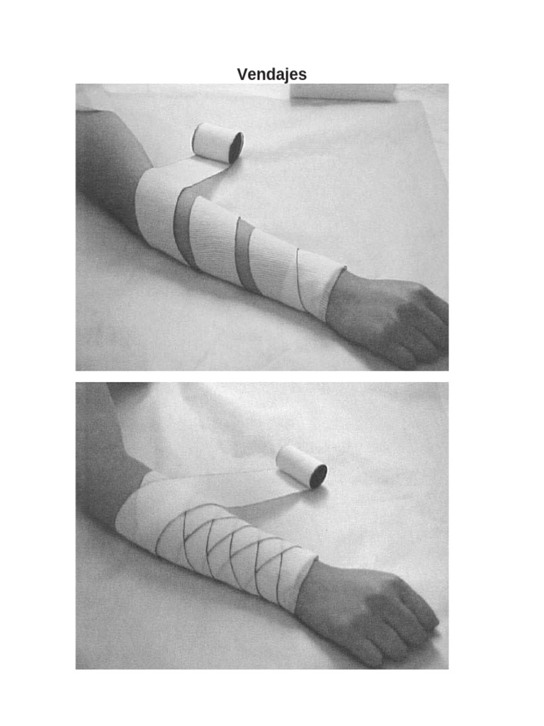 Vendajes | PDF